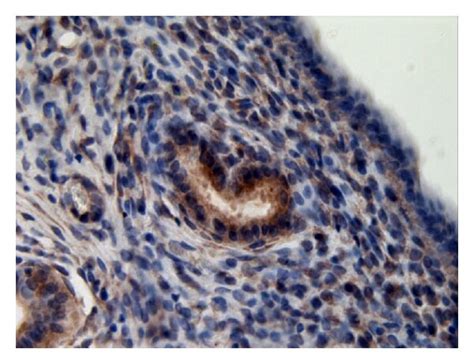 The Expression Of Erβ In Eutopic Endometrium Dab Stain ×400 A