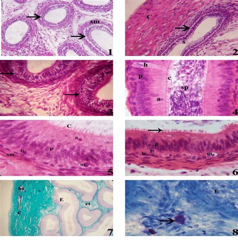 Simple Ciliated Columnar Epithelium