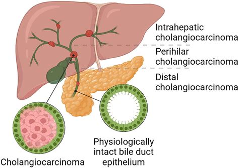 Frontiers Applications Of 3d Models In Cholangiocarcinoma