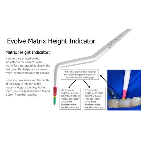 Bioclear Evolve Matrix Height Indicator Probe 500122