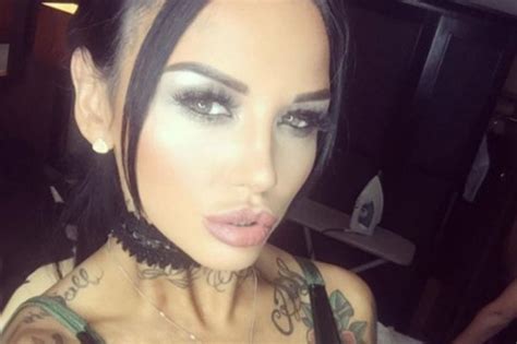 Big Brother Star Sallie Axl Gets Gruesome Plastic Surgery To Make