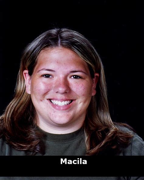 Bonding Transformation Gallery Amy Norman Dds Everett Wa