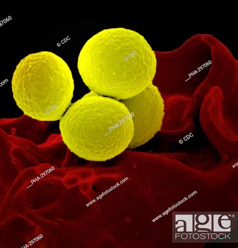 Coloured Scanning Electron Micrograph Sem Of Methicillin Resistant
