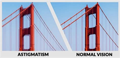 Astigmatism Vs Normal Vision How It Affects Your Sight