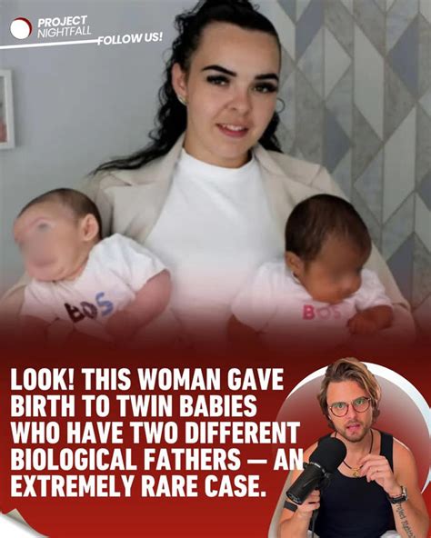 Impossible Twist Twins Born From Two Different Fathers