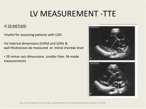 PPT EVALUATION OF SYSTOLIC FUNCTION OF LEFT VENTRICLE BY ECHOCARDIOGRAPHY PowerPoint