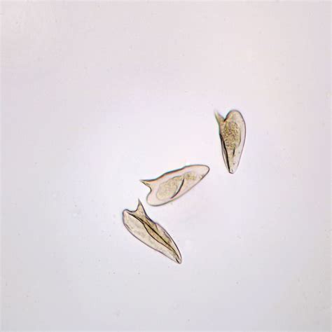 Schistosoma Mansoni Eggs Wm Microscope Slide Carolina Biological