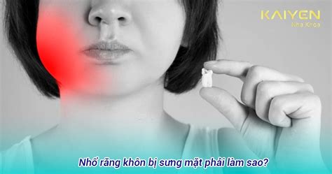 Nhổ Răng Khôn Bị Sưng Mặt Mấy Ngày Cách Giảm Sưng đau Hiệu Quả Nha