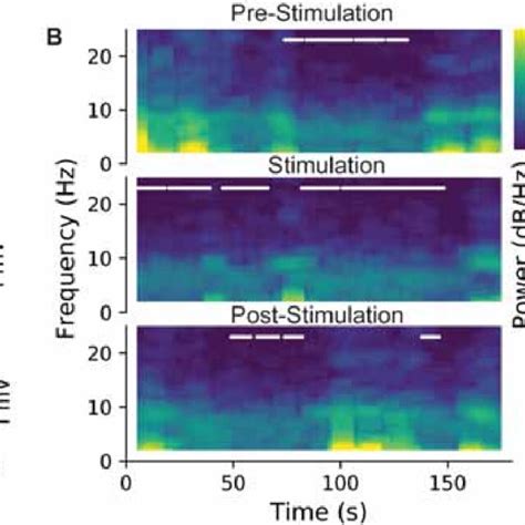 Lfp Characteristics During Locomotion And Stimulation 318 A Sample