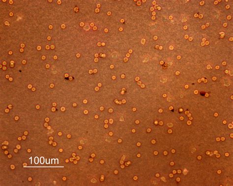 14 Questions With Answers In Inverted Microscopy Science Topic