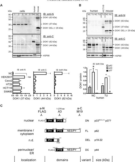 Figure 1 From Subcellular Compartmentalization Of Docking Protein 1 Contributes To Progression
