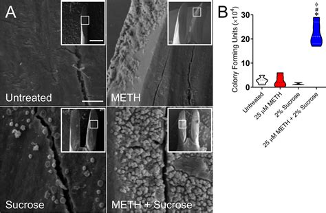 Teeth Of Methamphetamine Use Before And After