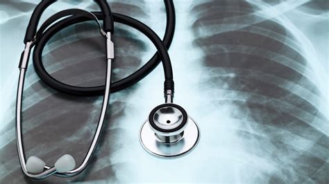 Cirugía de Tórax y Cardiovascular Cuidamos tu salud AUNA