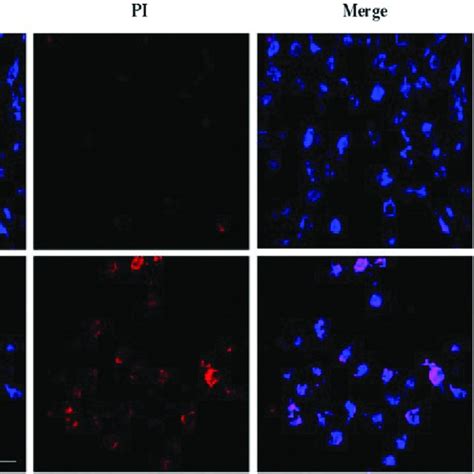 Dapi Pi Staining Of Untreated And Ligand Treated Hela Cells Panel A