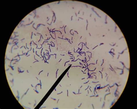 Bacilli Bacteria Under Microscope
