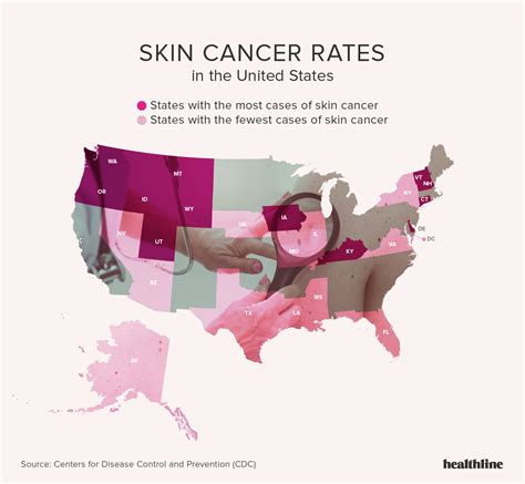 Cancer De La Peau Faits Statistiques Et Vous