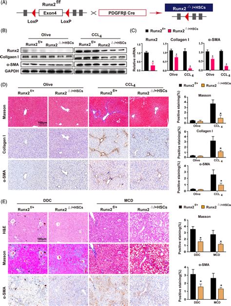 hsc‐specific knockdown of runx2 alleviates ccl4‐induced ddc‐induced or