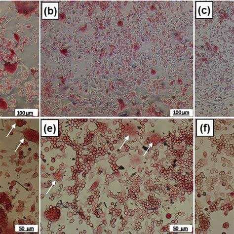 Trap Staining Of Raw 2647 Cells In Osteoclastogenic Media Containing