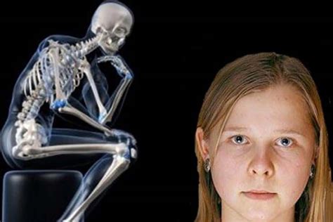 रशियन गर्ल की आंखों में X Ray विजन देख सकती है शरीर के अंदर लेकिन