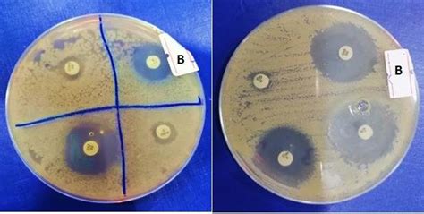 Antibiotic Susceptibility Profile Of Micrococcus Luteus Download