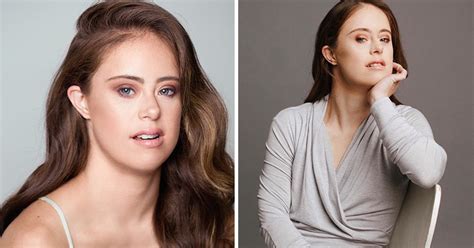 Champion Gymnast With Down Syndrome Beats The Odds To Become A Model