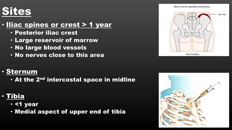 Bone Marrow Examination Pptx
