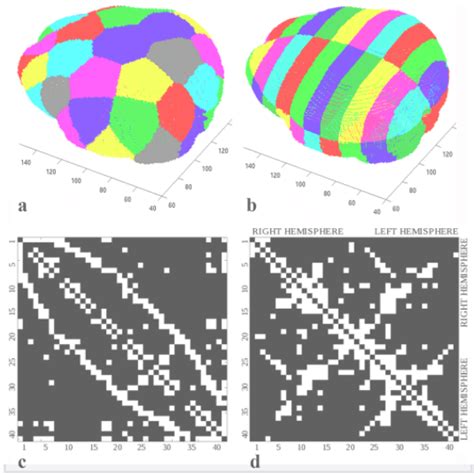 Are Neural Data Protected By Bodily Integrity A Discussion Of The Organic View On Neural Data