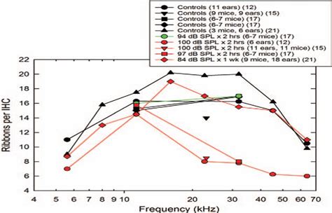 Speech In Noise Tests And Supra Threshold Auditory Evoked Po Otology And Neurotology