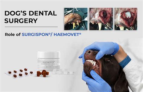 How Flowable Haemostatic Matrix Transforms Bleeding Control