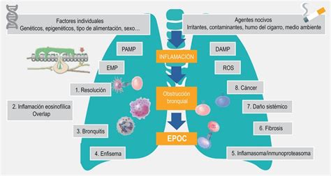 Inmunopatología De La Enfermedad Pulmonar Obstructiva Crónica