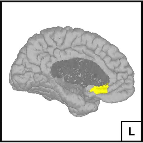 The Four Rois That Were Used In The Source Space Functional Download Scientific Diagram