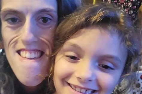 Woman With Facial Deformities Hits Back At Evil