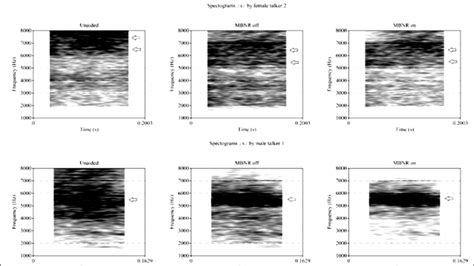 Spectrograms Of S Unaided And Pre And Post Processing By