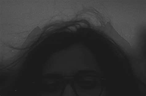 Weird Lines On Scan Of Kodak Print 2383 Ranalogcommunity