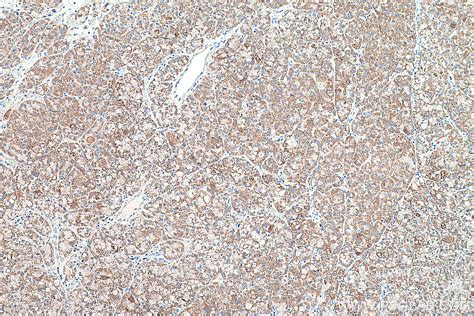 Ihceasy Ppif Ready To Use Ihc Kit Khc0447 Proteintech 武汉三鹰生物技术有限公司