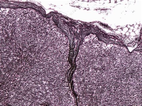 Lymph Node Human Lm Stock Image C0362297 Science Photo Library