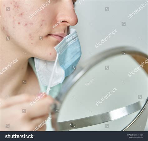 674 Women Have Blemishes Images, Stock Photos & Vectors | Shutterstock
