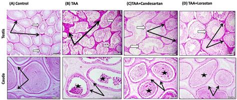 Sections Of Rat Testis And Cauda Epididymis Stained By Pas A Normal