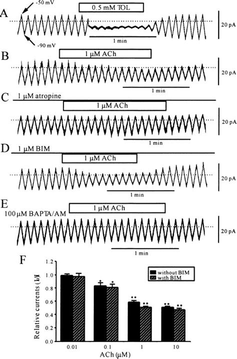 Pkc Independent Reduction Of Cell Membrane Currents Through K Atp By Download Scientific