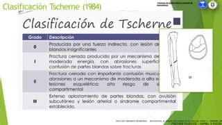 Fx Y Material De Osteosintesis De Tibia Listo Pptx