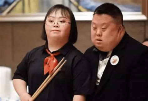 唐氏儿的症状图片唐氏儿婴儿耳朵的样子 伤感说说吧