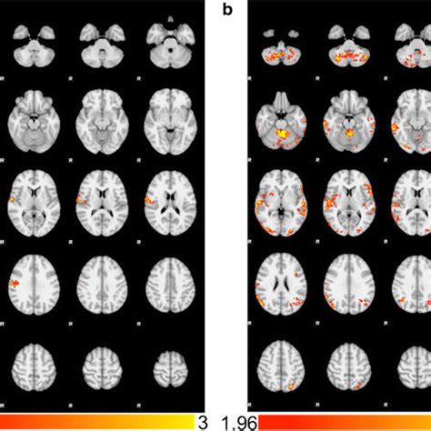 Correlations With Body Mass Index Bmi Bmi Was Positively Correlated