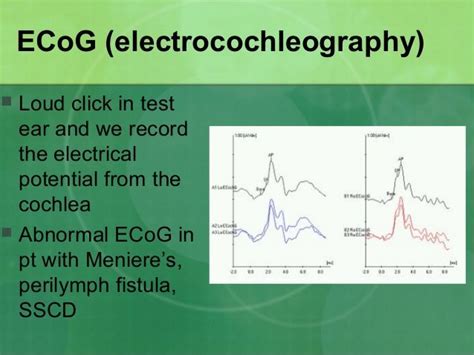 Exams And Me Electrocochleography