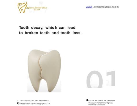 Ppt 5 Most Common Oral Health Diseases Lifecare Dental Clinic