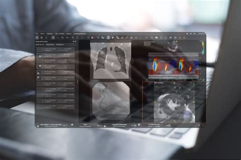 Siim 2025 Mach7 Technologies Siim 2025 Mach7 Technologies