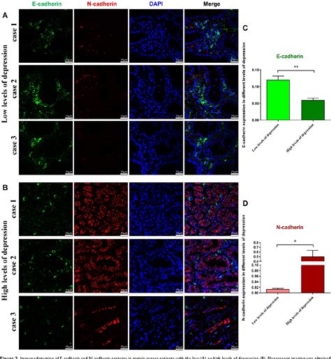 Figure 1 From Chronic Stress Model Simulated By Salbutamol Promotes