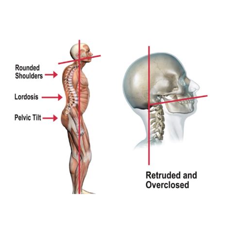 Freedom From Pain Institute Llc On Linkedin With The Head In Forward