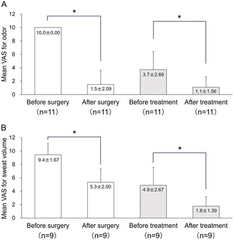 Effectiveness Of Sofpironium Bromide In Patients With Primary Axillary Hyperhidrosis Who
