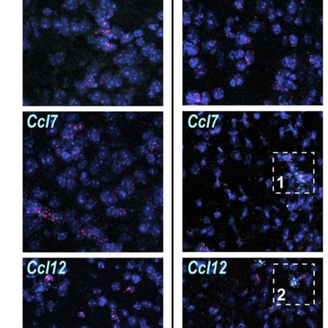 Ccl7 And Ccl12 Mrna Transcription Levels Are Markedly Elevated In Brain Download Scientific