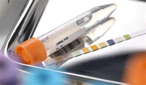 Urodynamic Interpretation In Need Of Universal Methods Vanderbilt